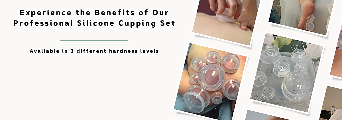 Cupping Therapy | Global Cupping